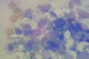 Prostate cytology - WikiVet English